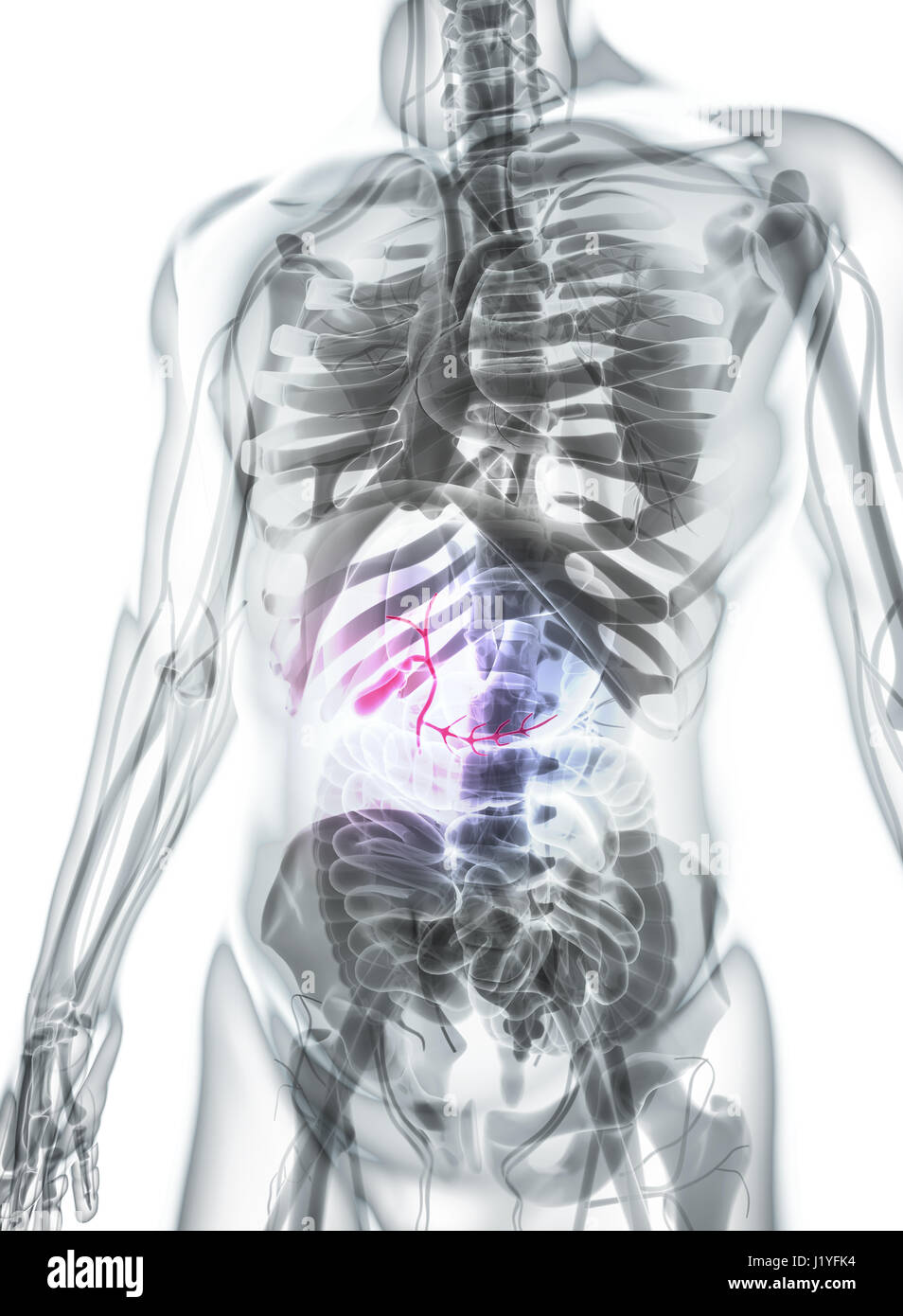 Gallstones hi-res stock photography and images - Alamy