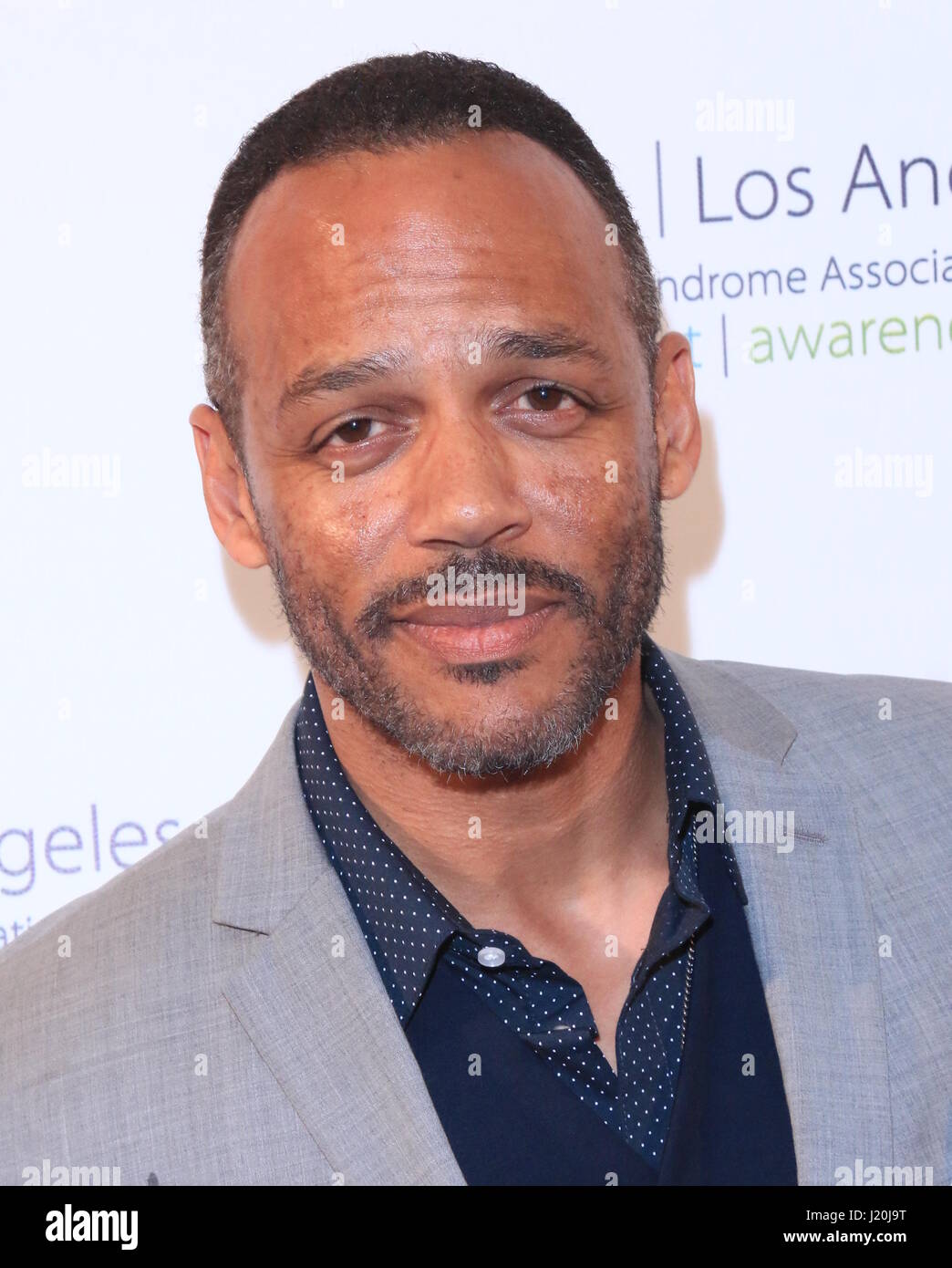 DSALA presents 'My Feral Heart' screening in celebration of World Down ...