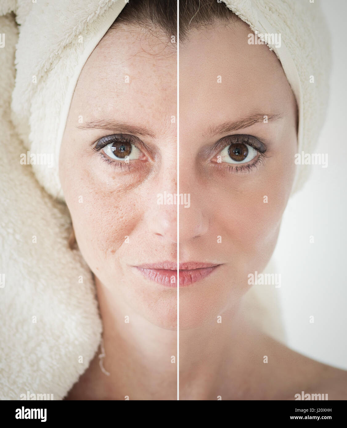 beauty concept - skin care, anti-aging procedures, rejuvenation ...