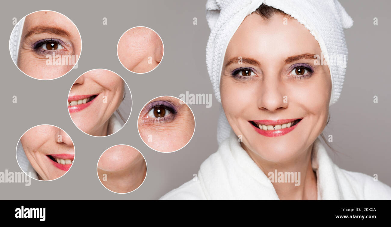 happy woman after beauty treatment - before/after shots - skin care ...