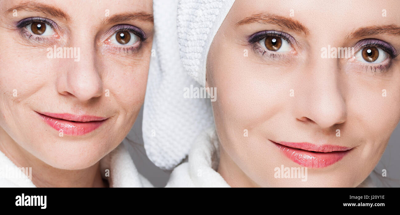 happy woman after beauty treatment - before/after shots - skin care ...