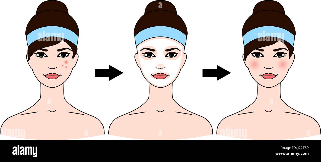 Step-by-step use of facial masks from acne on white background Stock ...