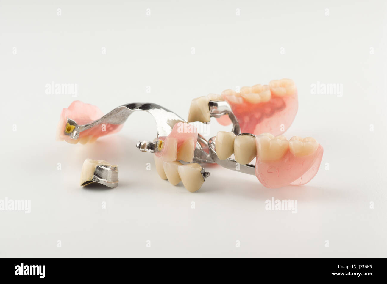Clasp prosthesis with lock fixation on a white background Stock Photo ...
