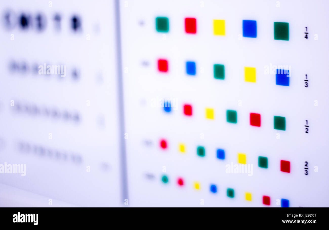 Opticians ophthalmology and optometry eye test chart to test sight and ...