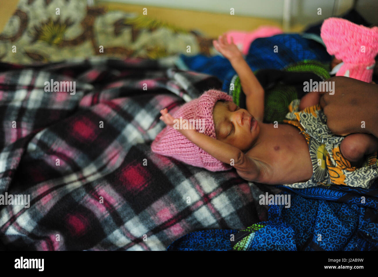 Malawi, Northern Region, Rumphi, mother tying her underweight baby to ...