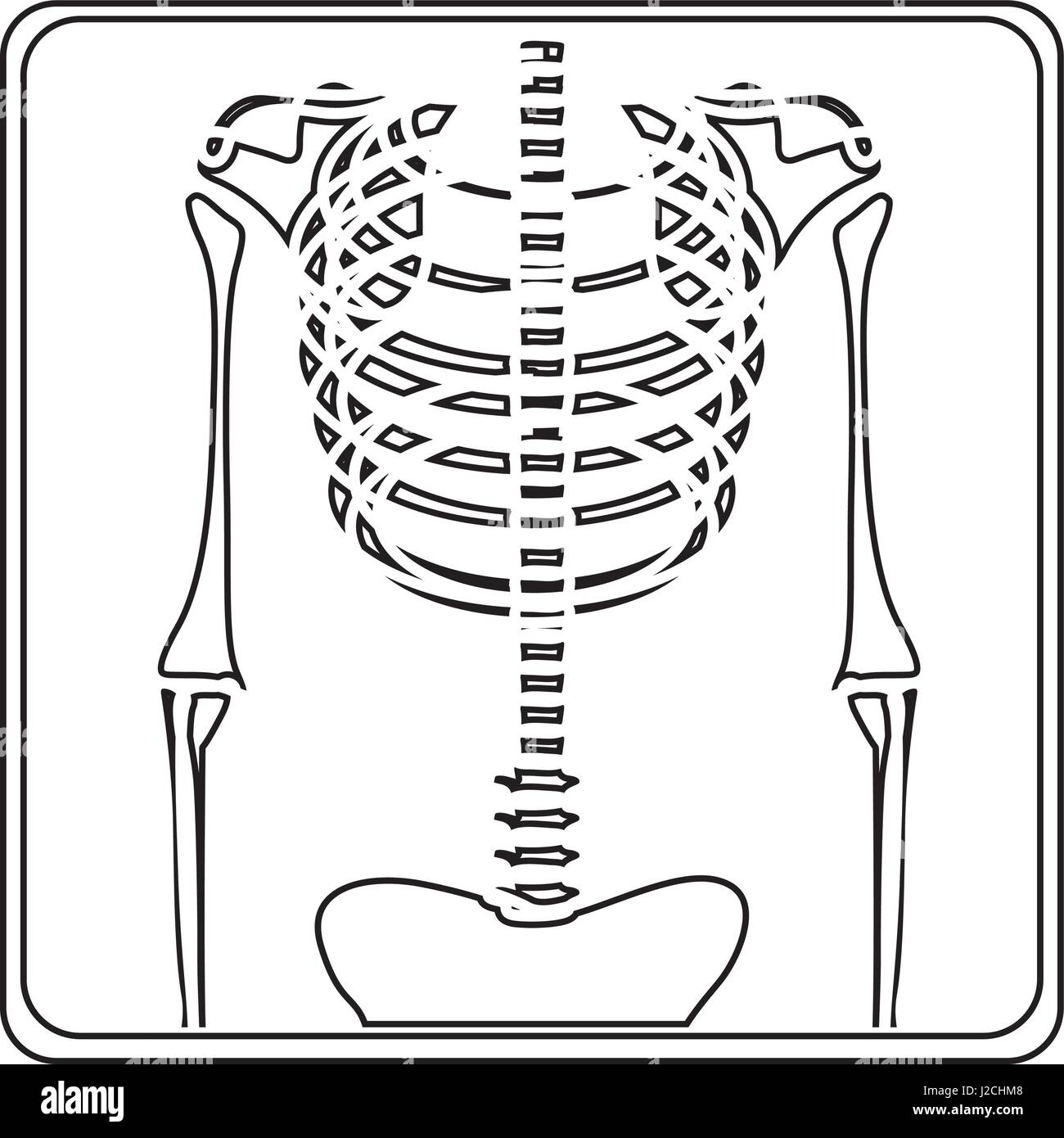 Vertebrae x ray Stock Vector Images - Alamy