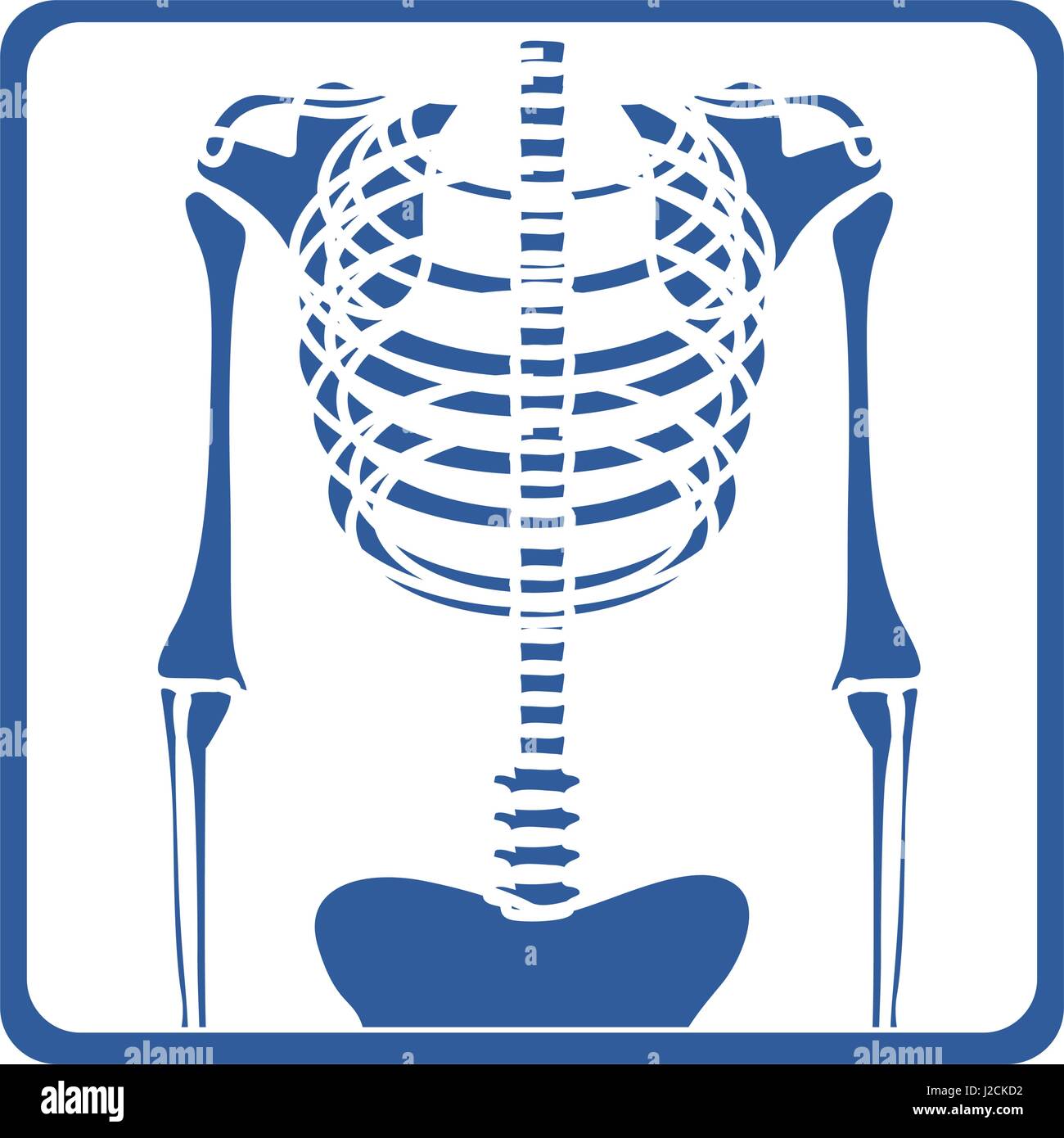 Tibia bone fracture Stock Vector Images - Alamy