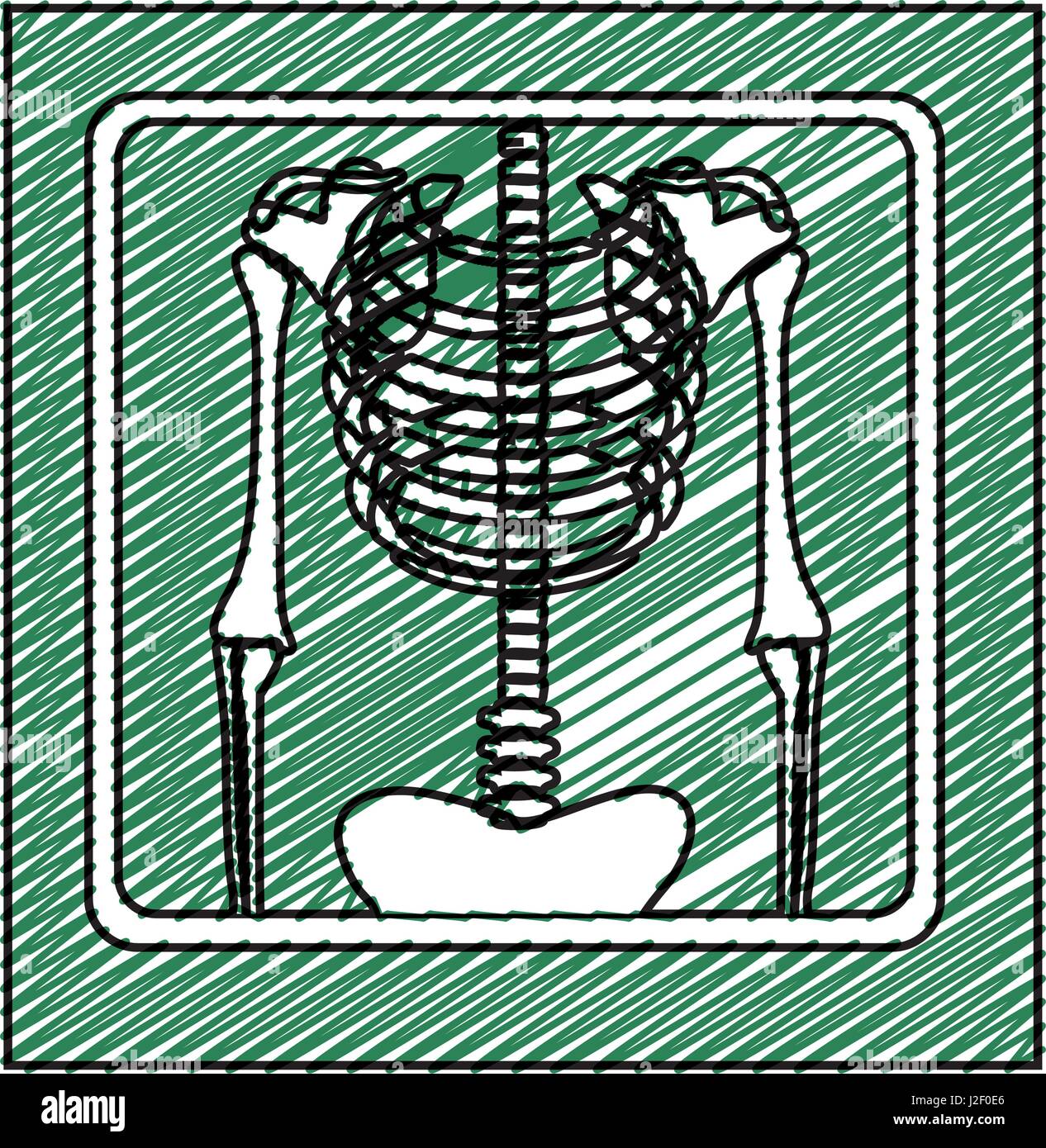 X Ray Drawing High Resolution Stock Photography and Images - Alamy