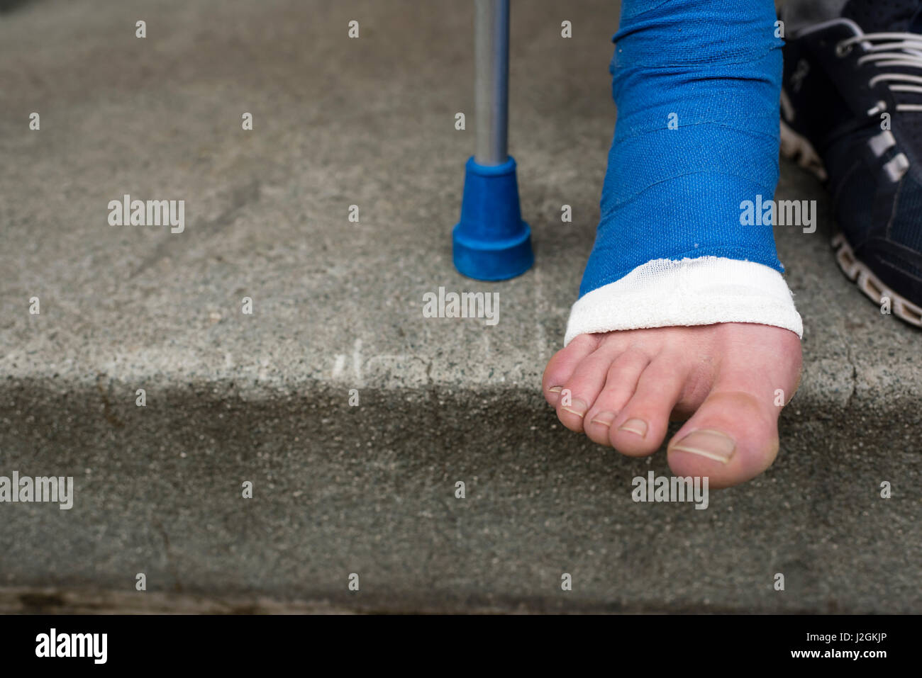 Crutches leg in plaster hi-res stock photography and images - Alamy