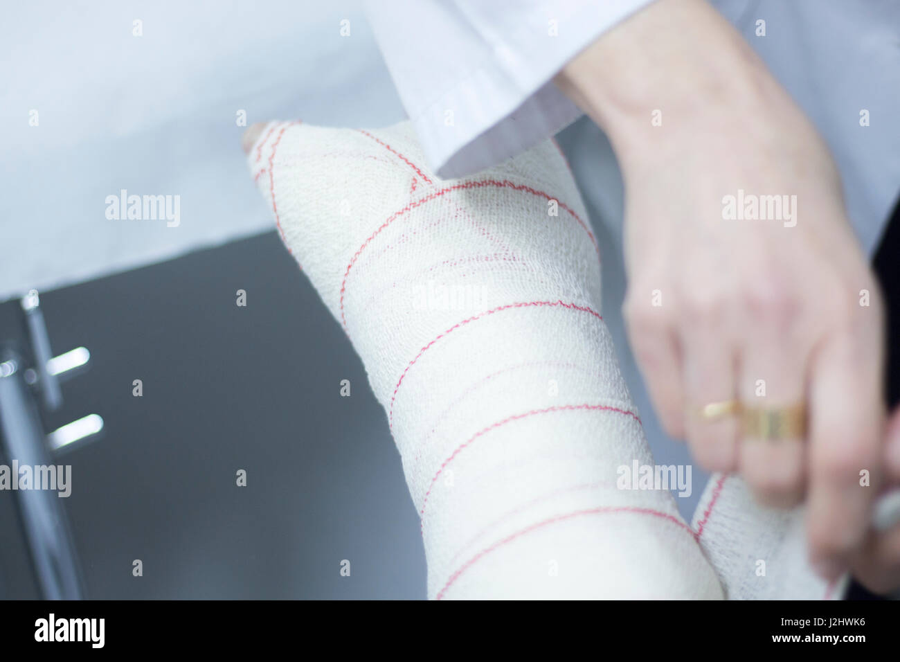 Doctor applying plaster cast bandages hi-res stock photography and ...