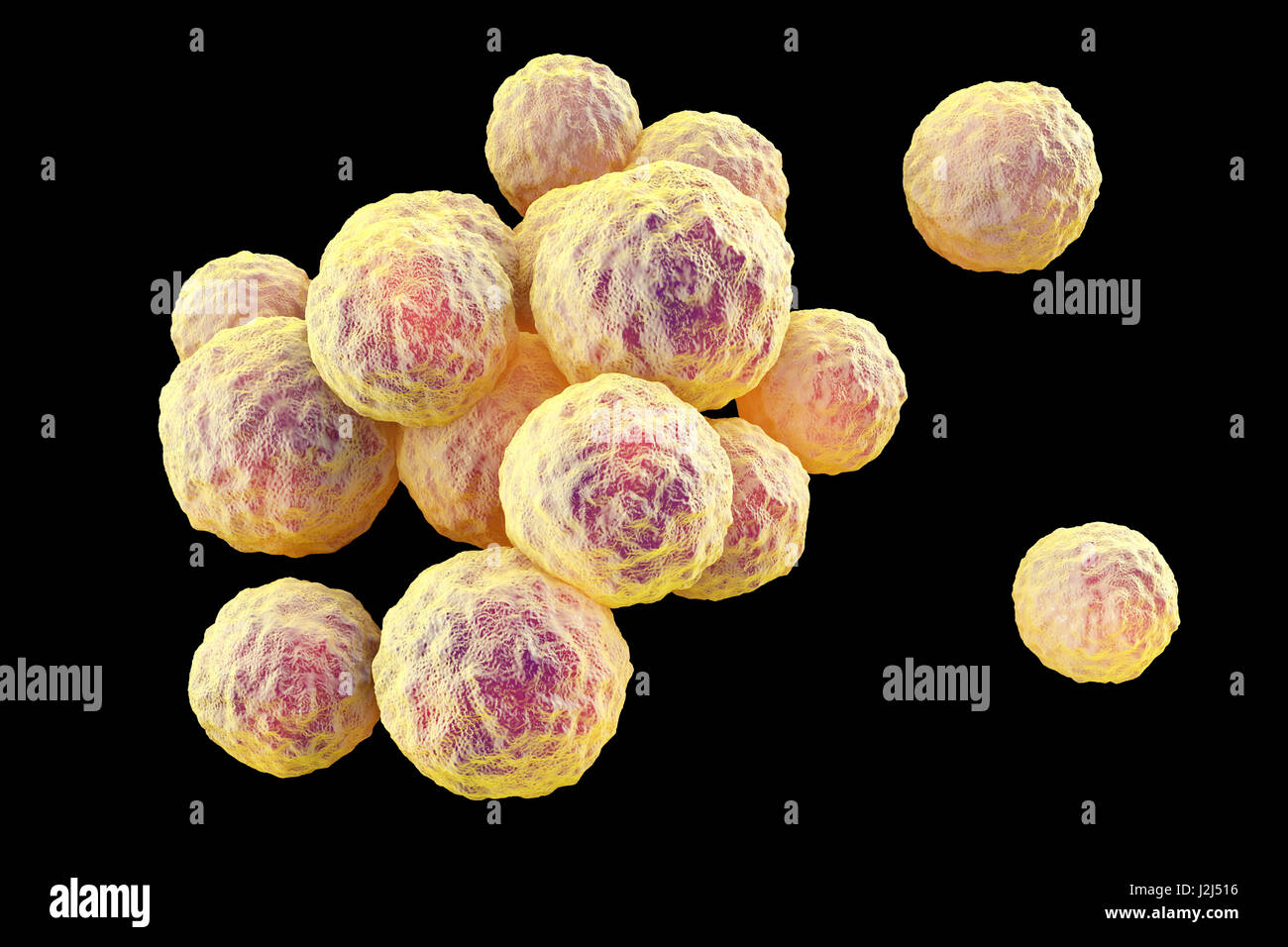 MRSA bacteria. Computer artwork of methicillin-resistant Staphylococcus aureus (MRSA) bacteria ...