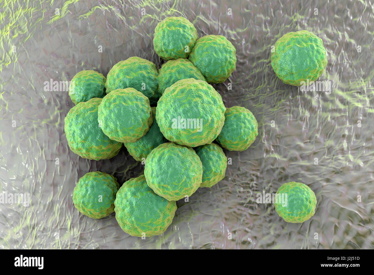 Mrsa infection hi-res stock photography and images - Alamy
