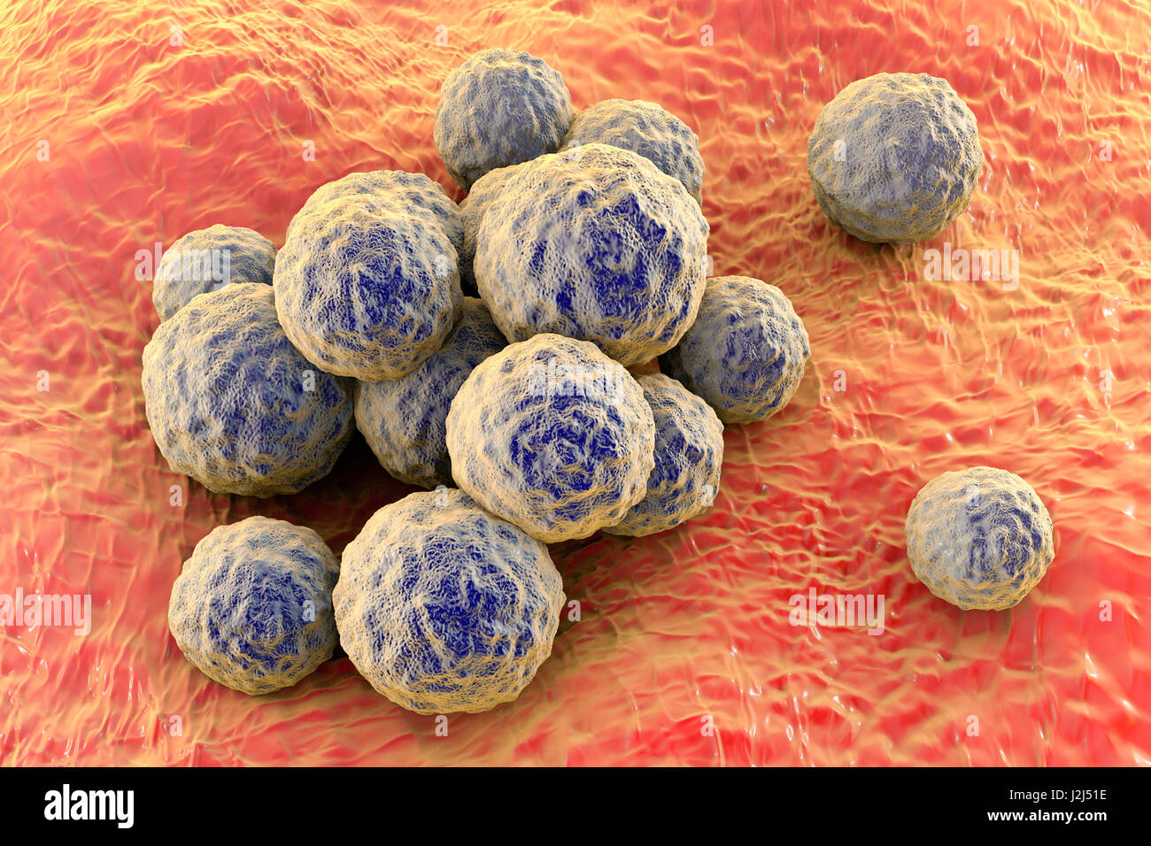 MRSA bacteria. Computer artwork of methicillin-resistant Staphylococcus ...