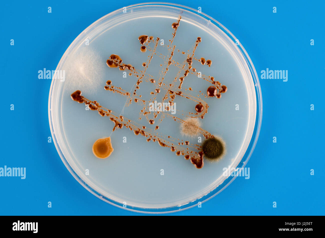Petri Dish Bacteria Identification