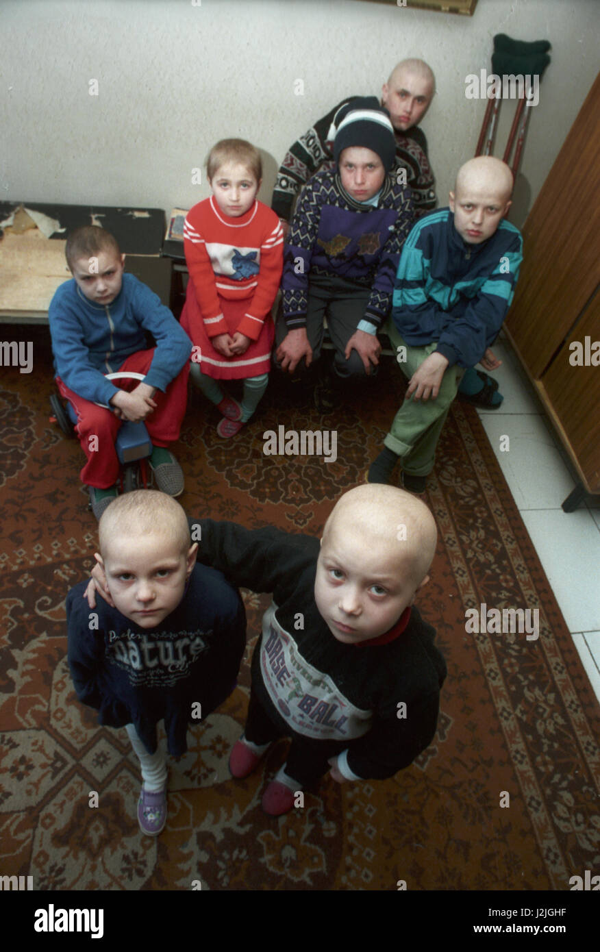 Ukraine. Chernobyl. Sick children Stock Photo - Alamy