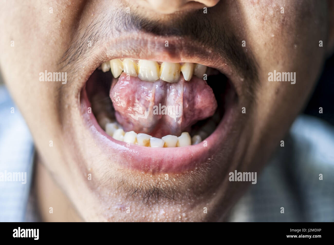 A boy showing his teeth Stock Photo - Alamy