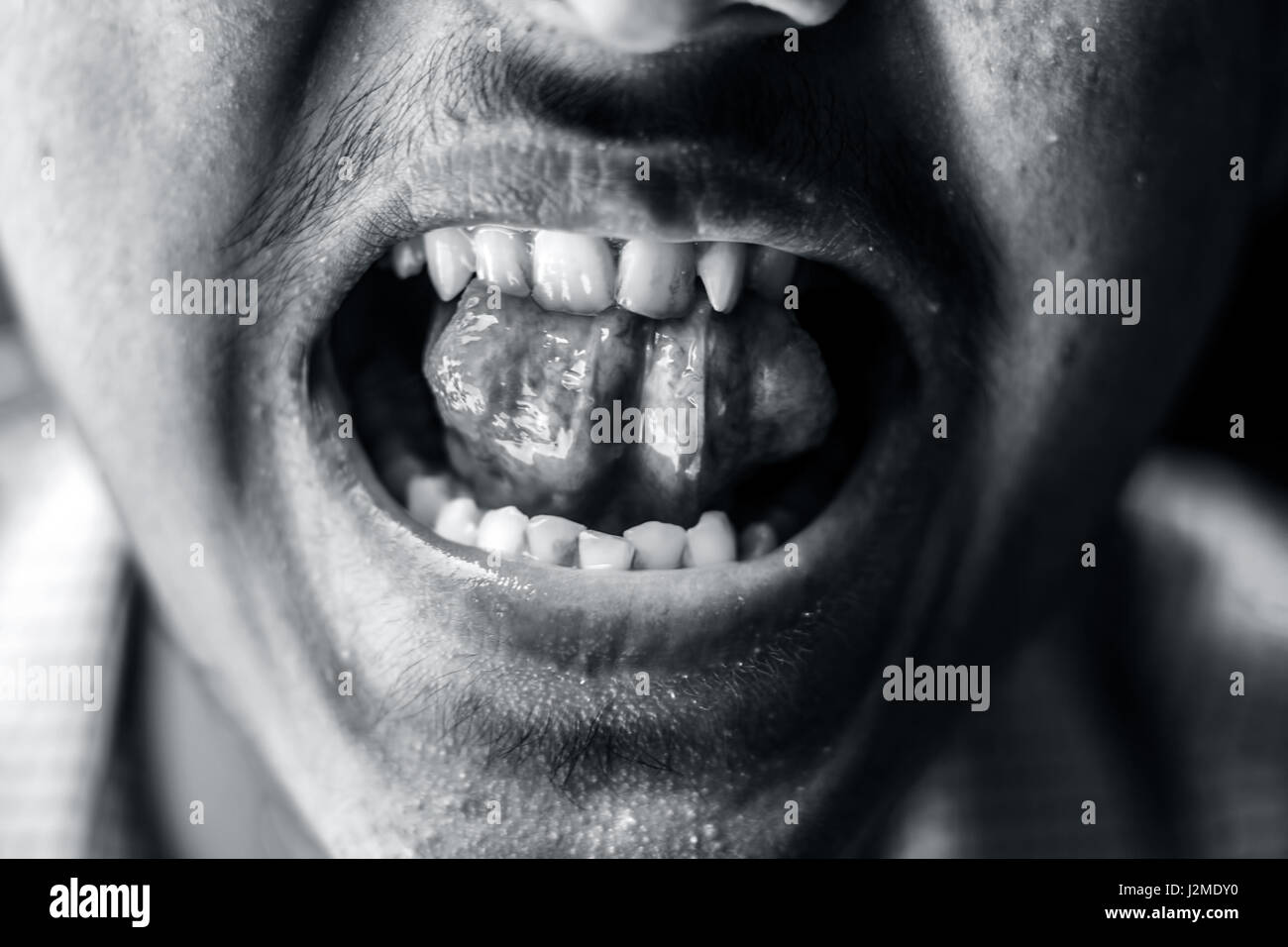 A boy showing his teeth Stock Photo - Alamy