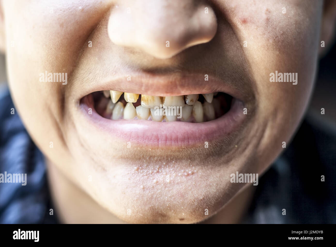 A boy showing his teeth Stock Photo - Alamy
