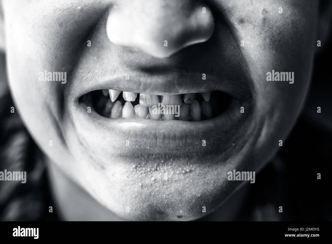 A boy showing his teeth Stock Photo - Alamy
