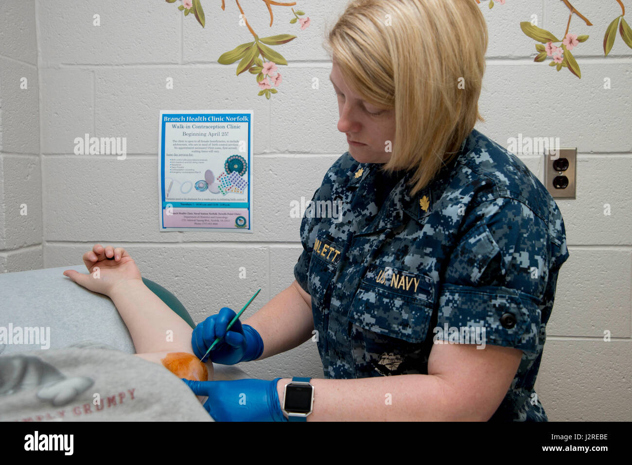 Birth Control Methods In Arm