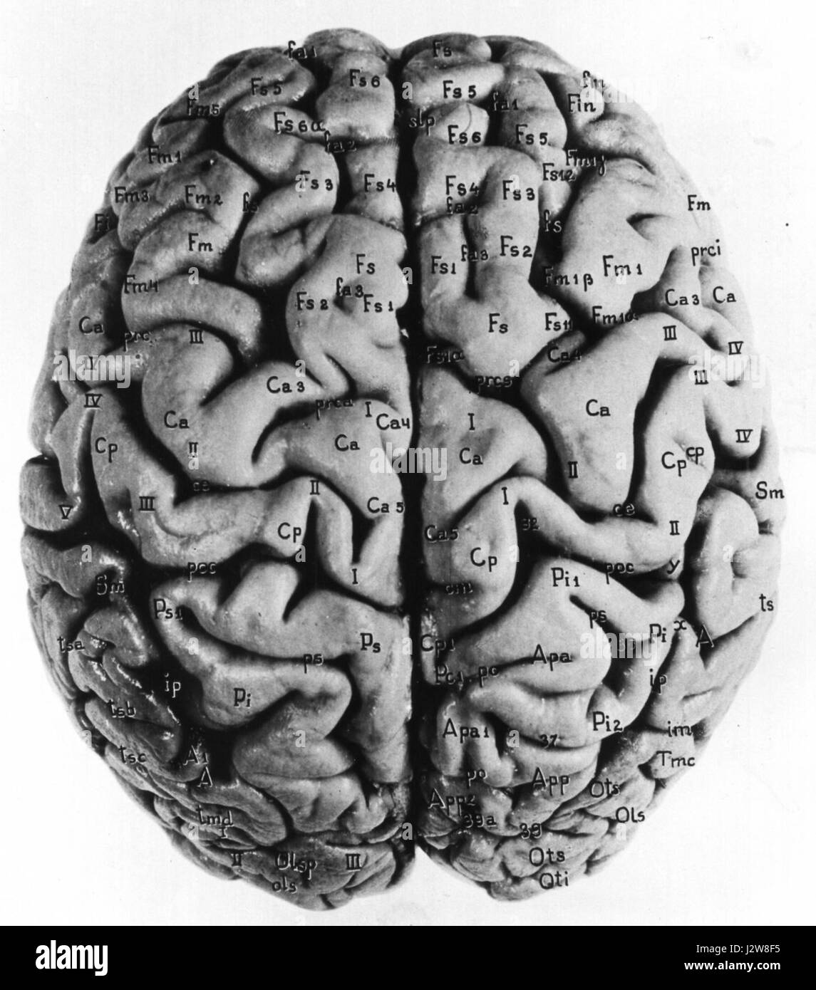 Neurofunctional hi-res stock photography and images - Alamy