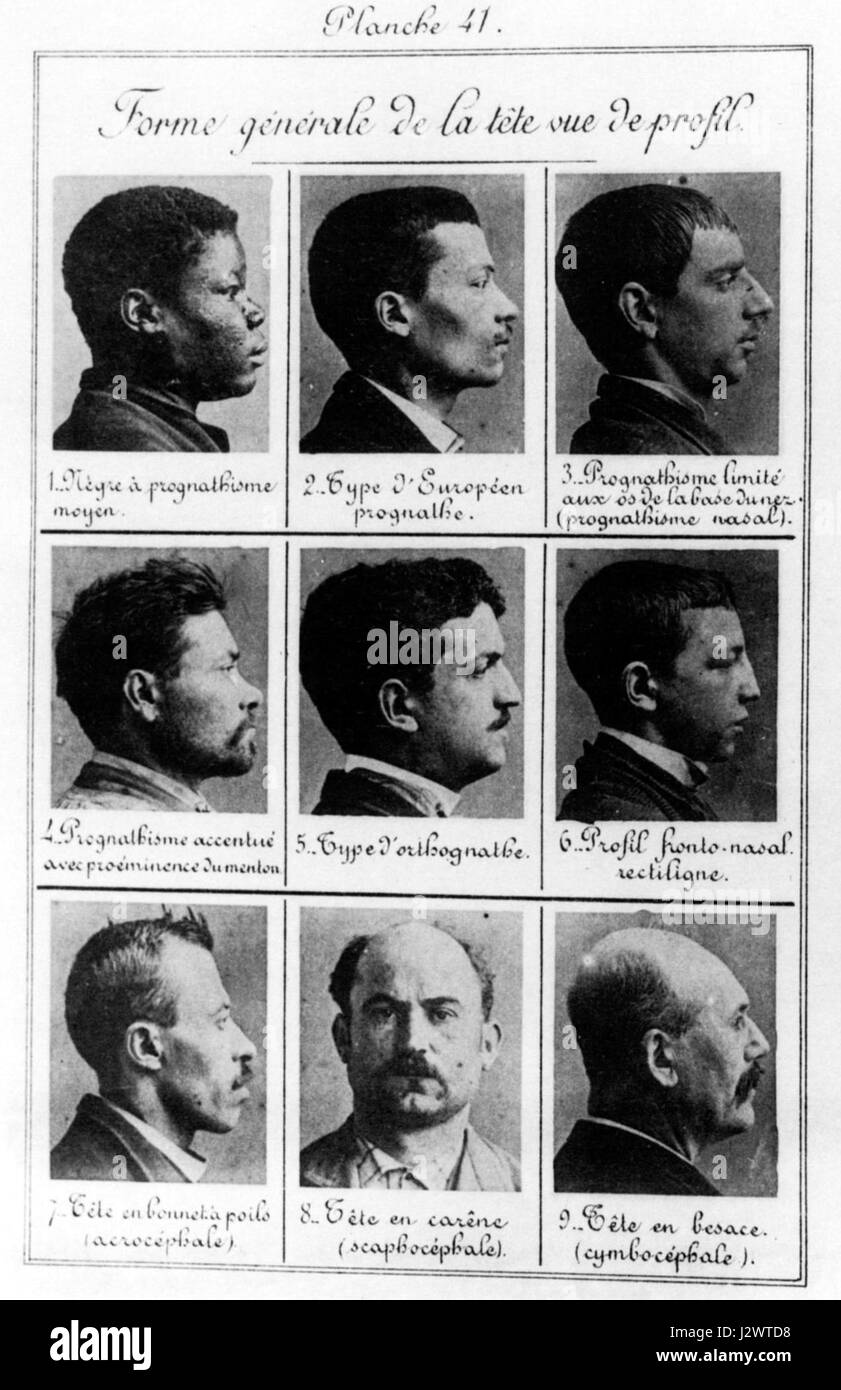 Bertillon criminal profiles hi-res stock photography and images - Alamy