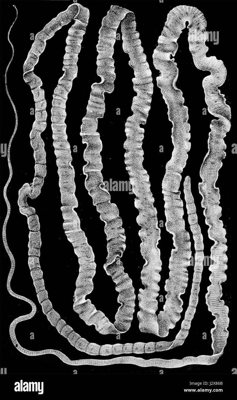 Human fish tapeworm hi-res stock photography and images - Alamy