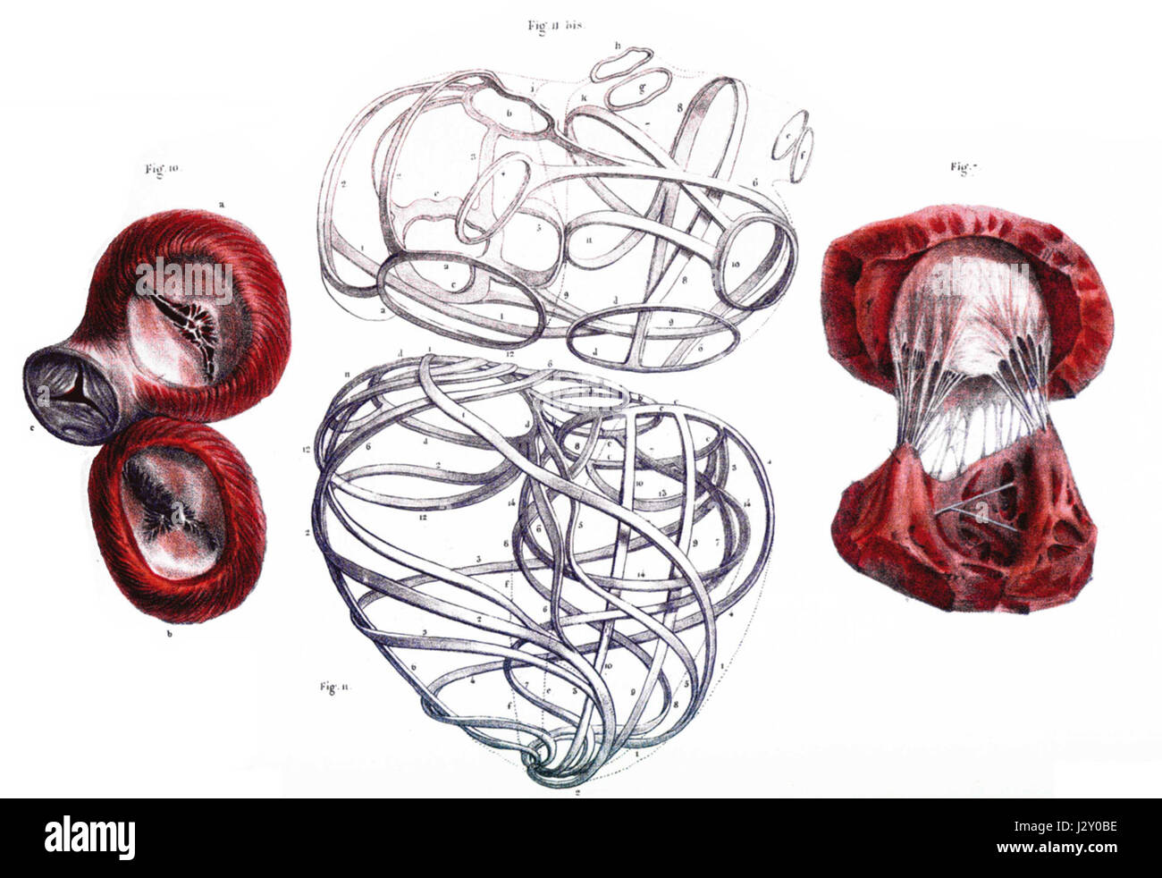 Angiologie hi-res stock photography and images - Alamy