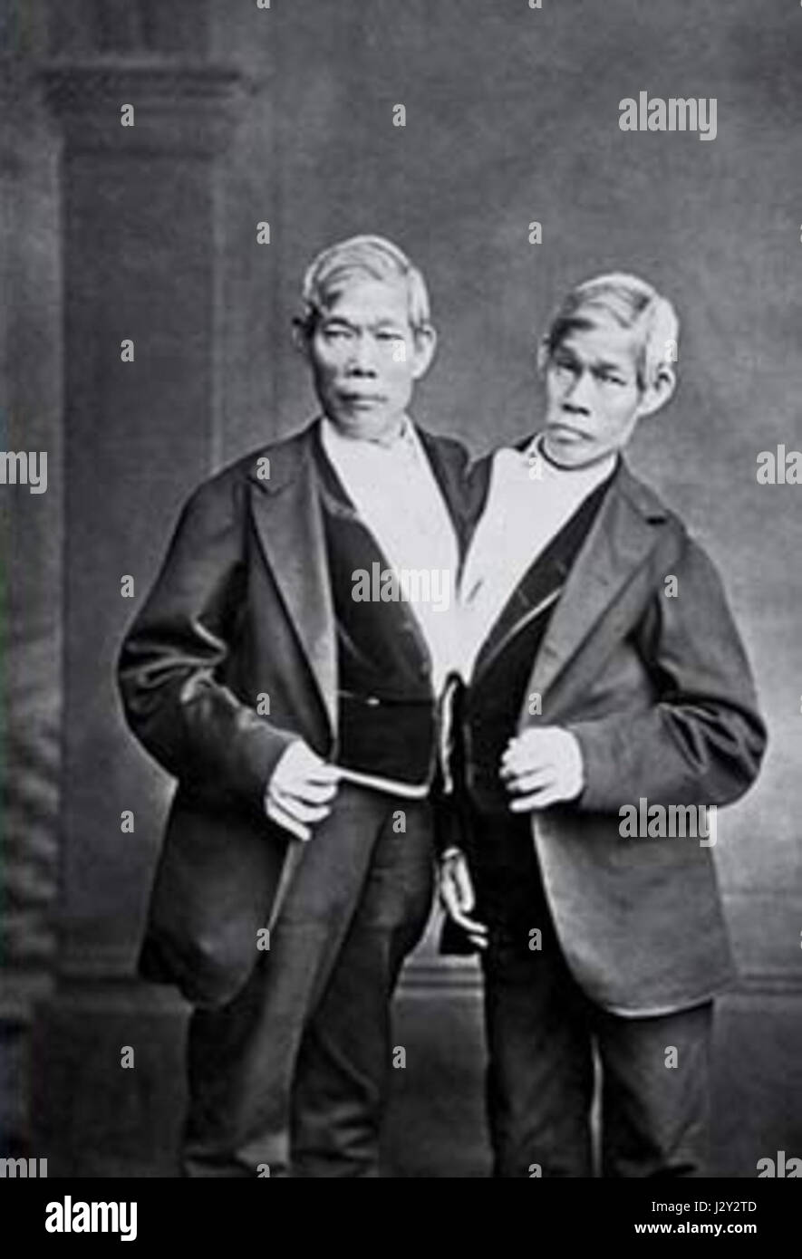 Chang and Eng Bunker were famous conjoined twins from Thailand, known for their worldwide tours ...