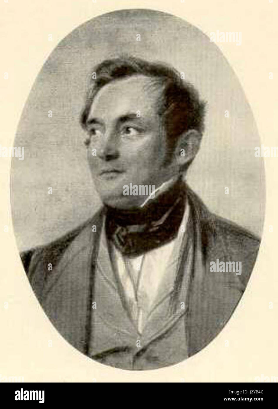 Basedow disease hi-res stock photography and images - Alamy