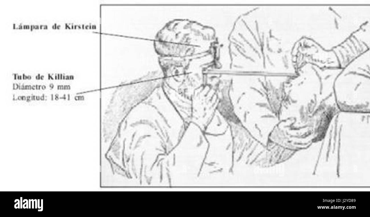 Bronchoskopie hi-res stock photography and images - Alamy