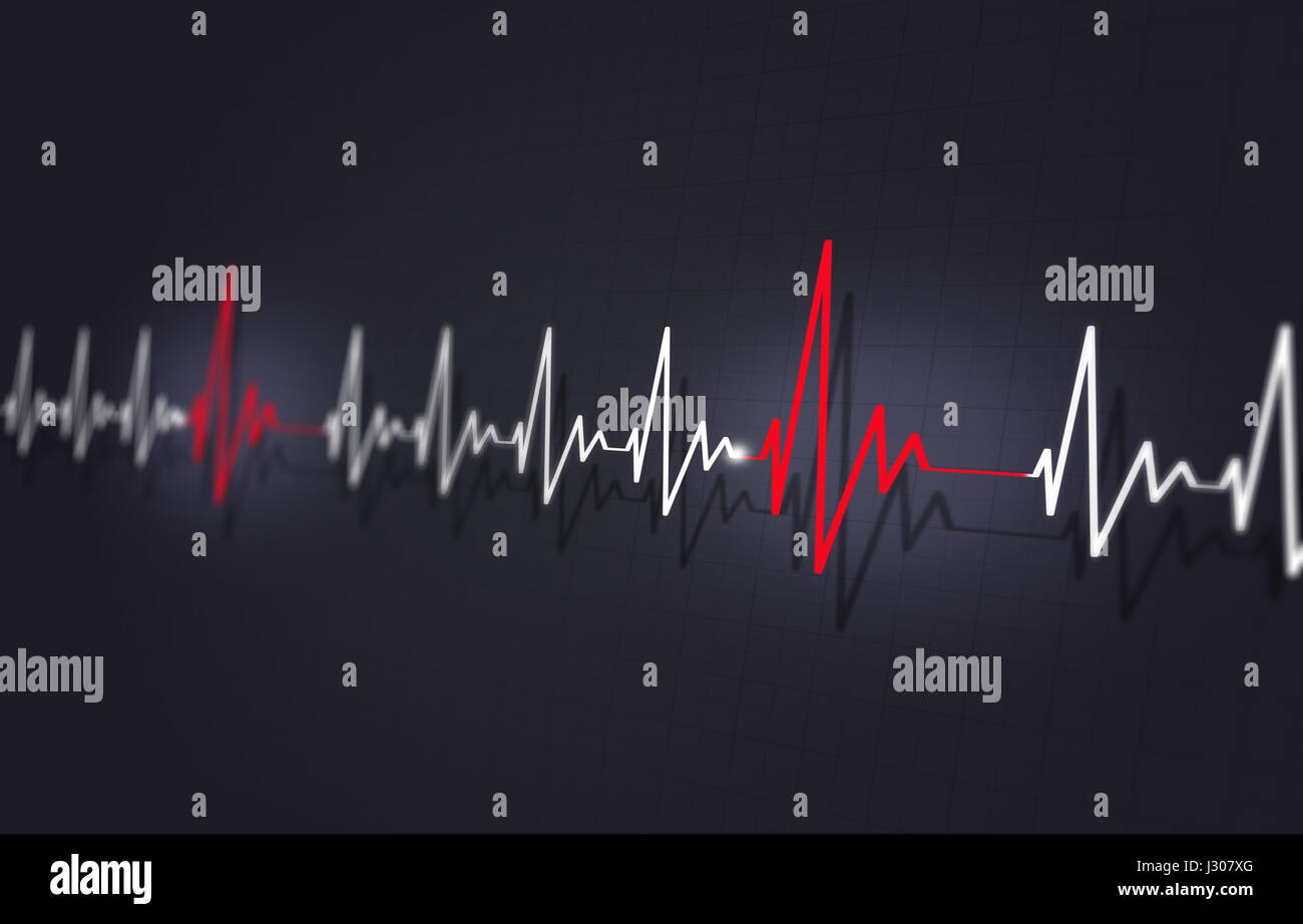 medicine illustration of heart disease irregular fast pulse Stock Photo ...