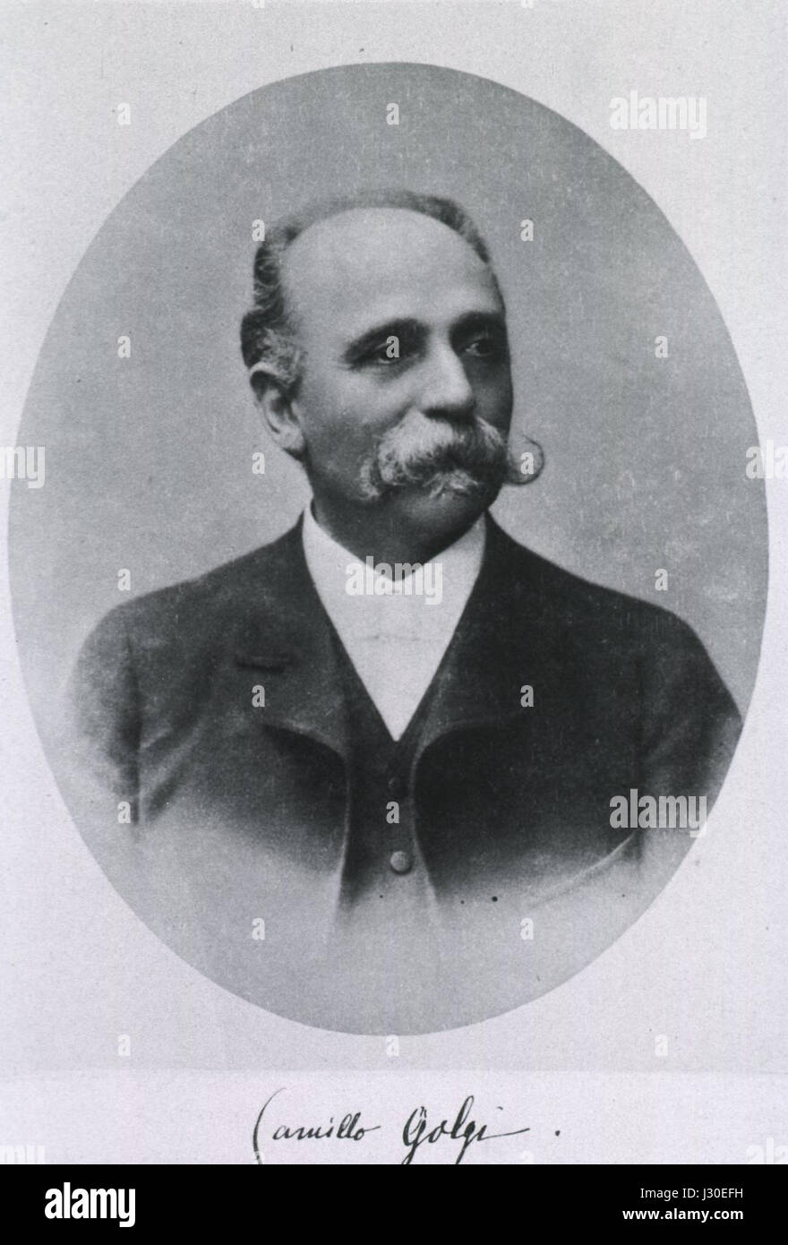 C. Golgi refers to Camillo Golgi, an Italian physician and scientist who made significant ...