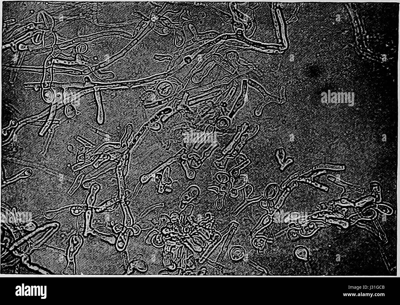 Blastomyces dermatitidis hi-res stock photography and images - Alamy