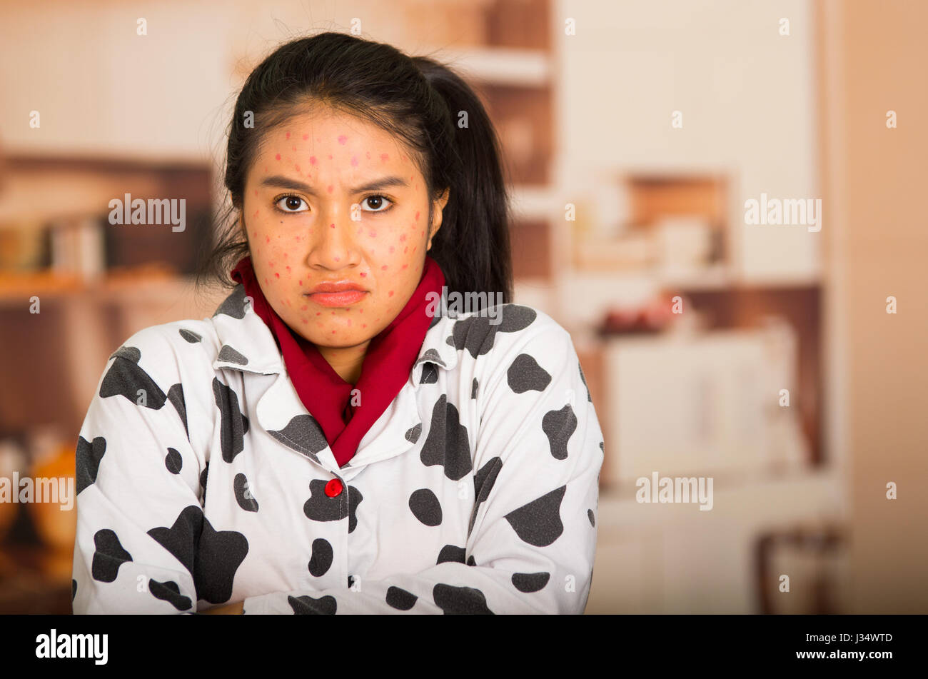 Smallpox scar hi-res stock photography and images - Alamy