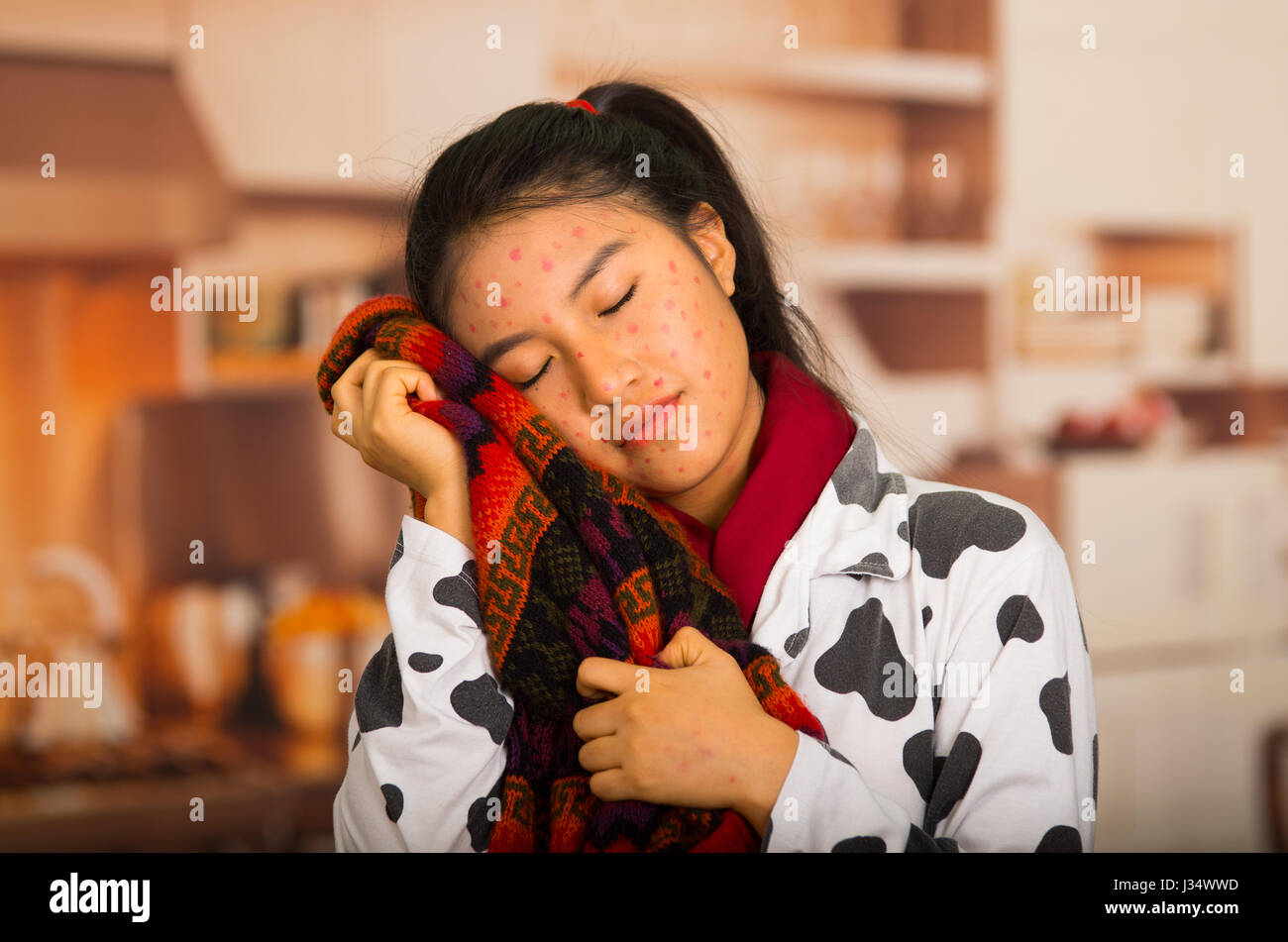 Smallpox scar hi-res stock photography and images - Alamy