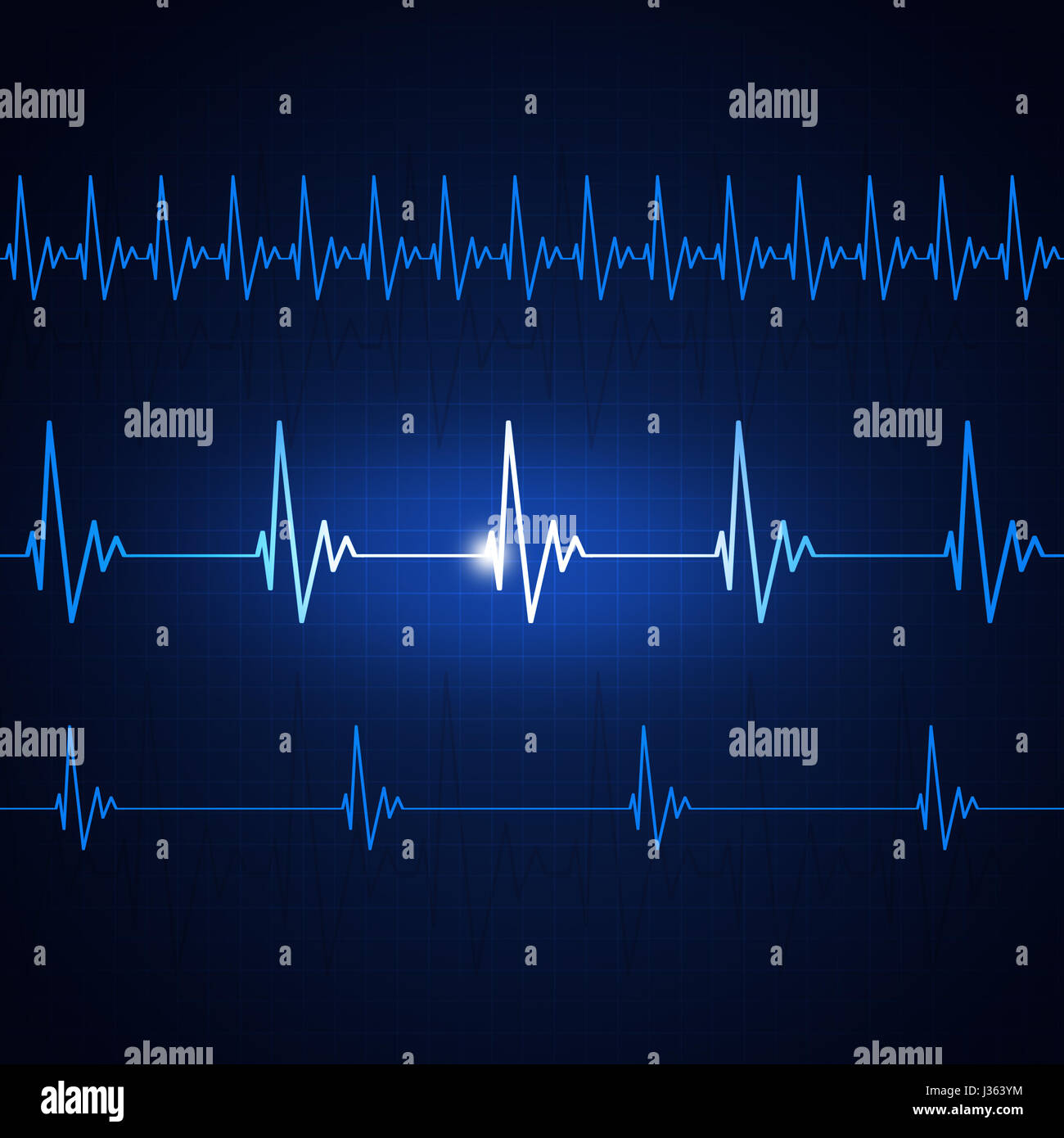 abstract heart pulsating different rhythms graph blue background Stock ...