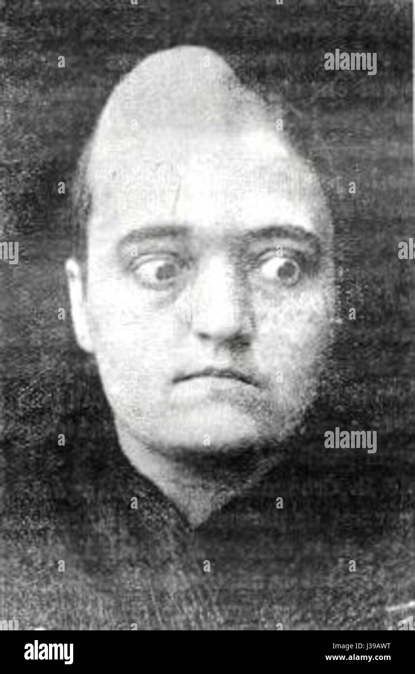 Crouzon syndrome is a genetic disorder characterized by the premature ...