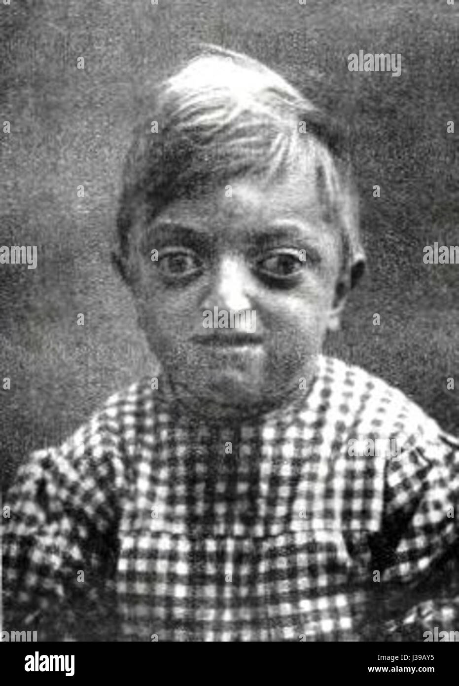 Abnormal skeletal features hi-res stock photography and images - Alamy