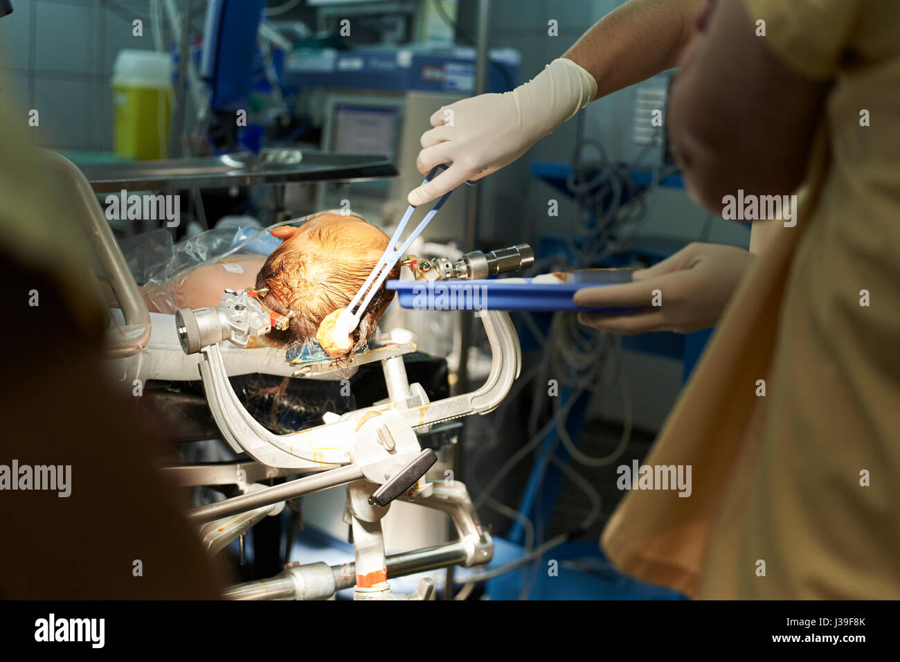 PEDIATRIC NEUROSURGERY Stock Photo - Alamy