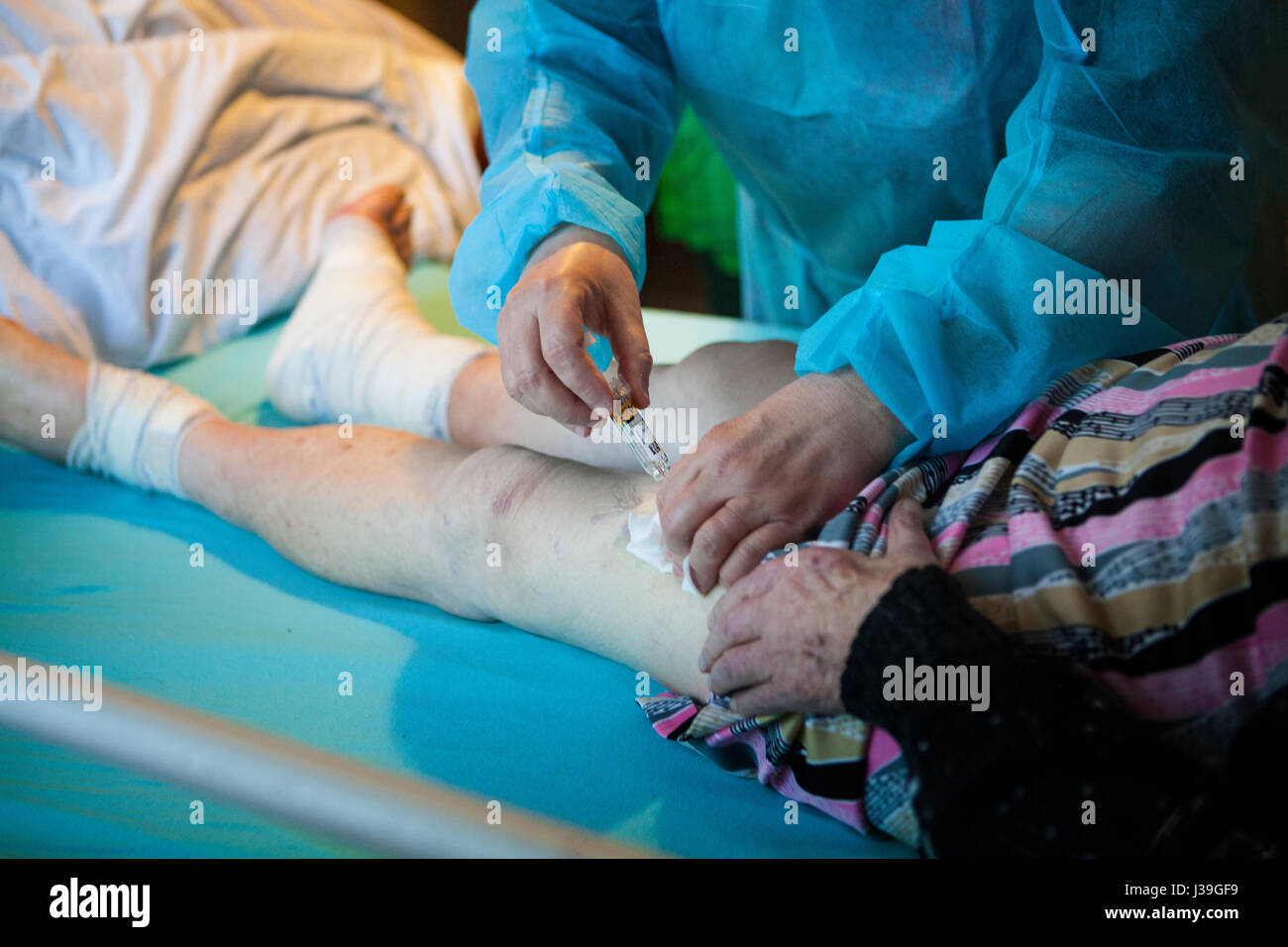 Eschars leg hi-res stock photography and images - Alamy