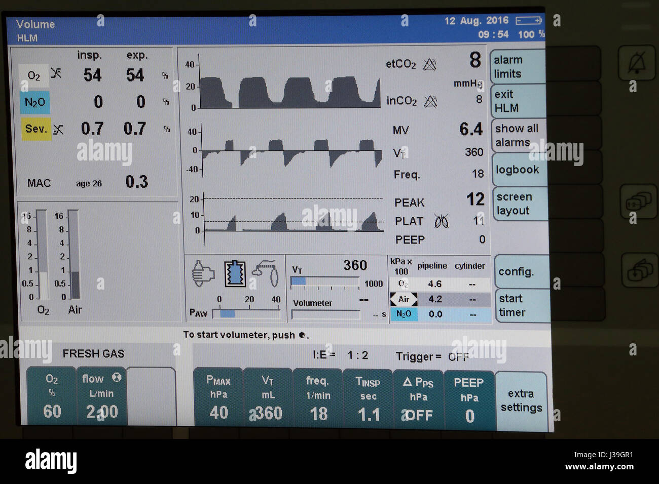 Operating theater. anesthesia. monitoring Stock Photo - Alamy