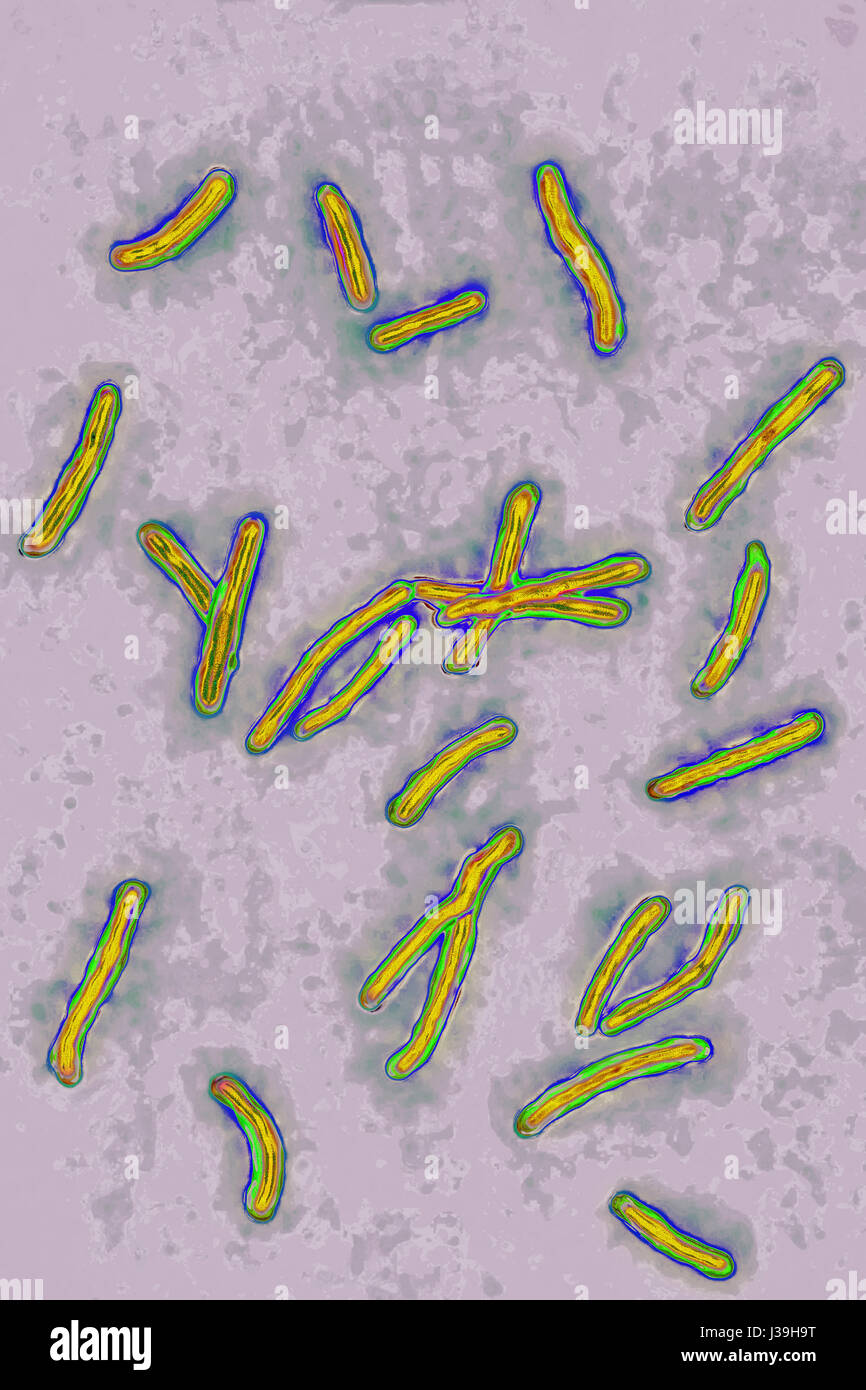 Tuberculosis Microscope Stock Photos & Tuberculosis Microscope Stock ...