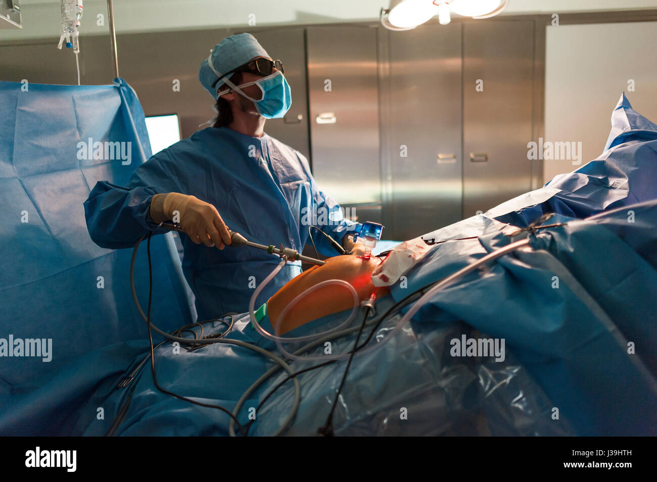 Gynecological operations hi-res stock photography and images - Alamy