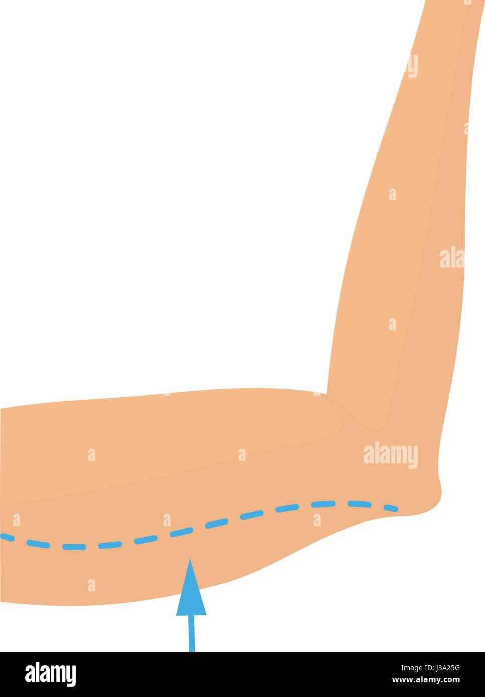 Woman body correction liposuction Stock Vector Images - Alamy