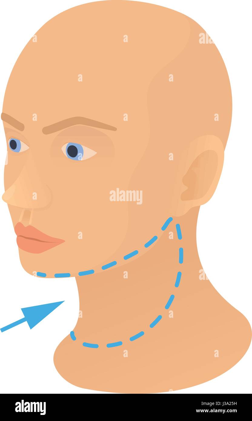 Neck plastic correction icon, cartoon style Stock Vector Image & Art ...