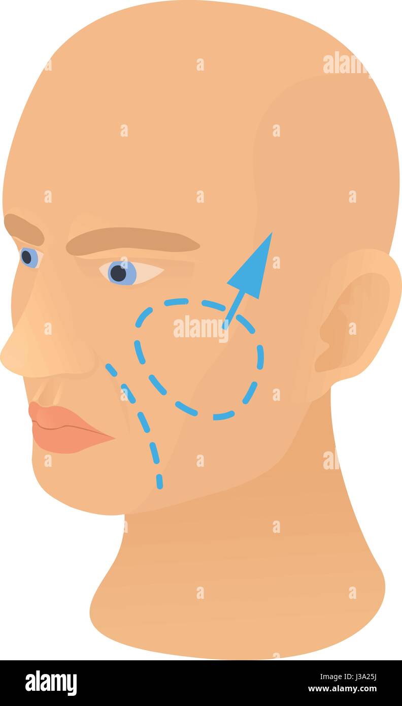 Cheek plastic correction icon, cartoon style Stock Vector Image & Art ...