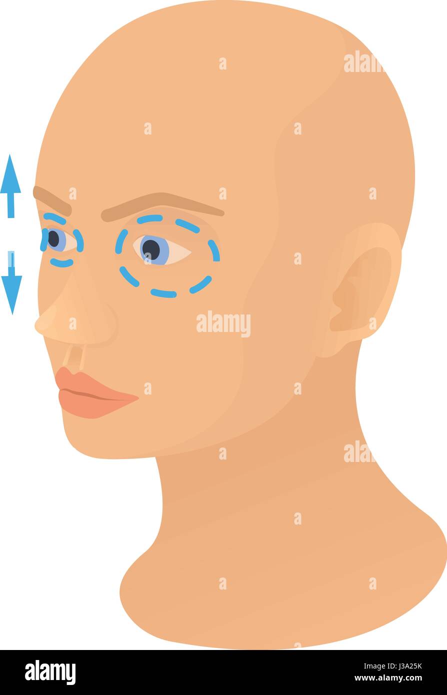 Eyelids plastic correction icon, cartoon style Stock Vector Image & Art ...