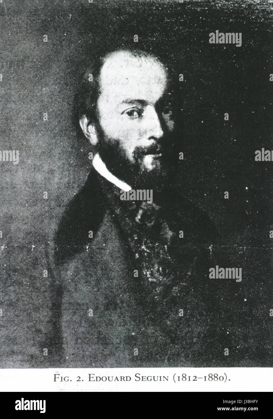Edouard Seguin (1812 1880 Stock Photo - Alamy