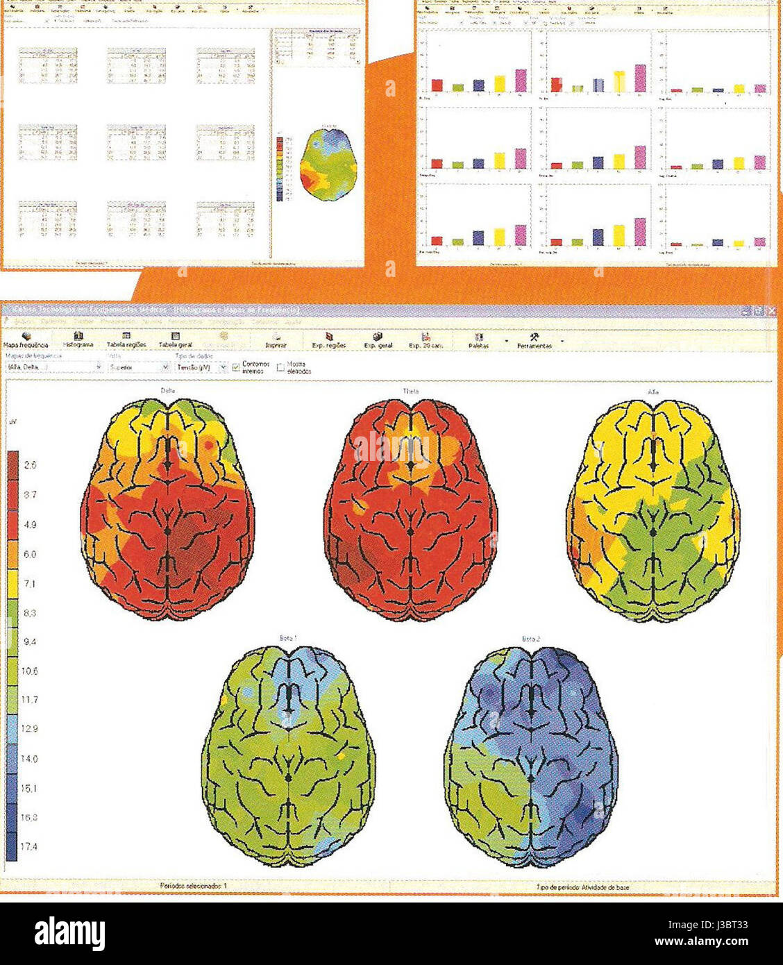 EEG Digital 2 refers to a digital platform or system related to ...